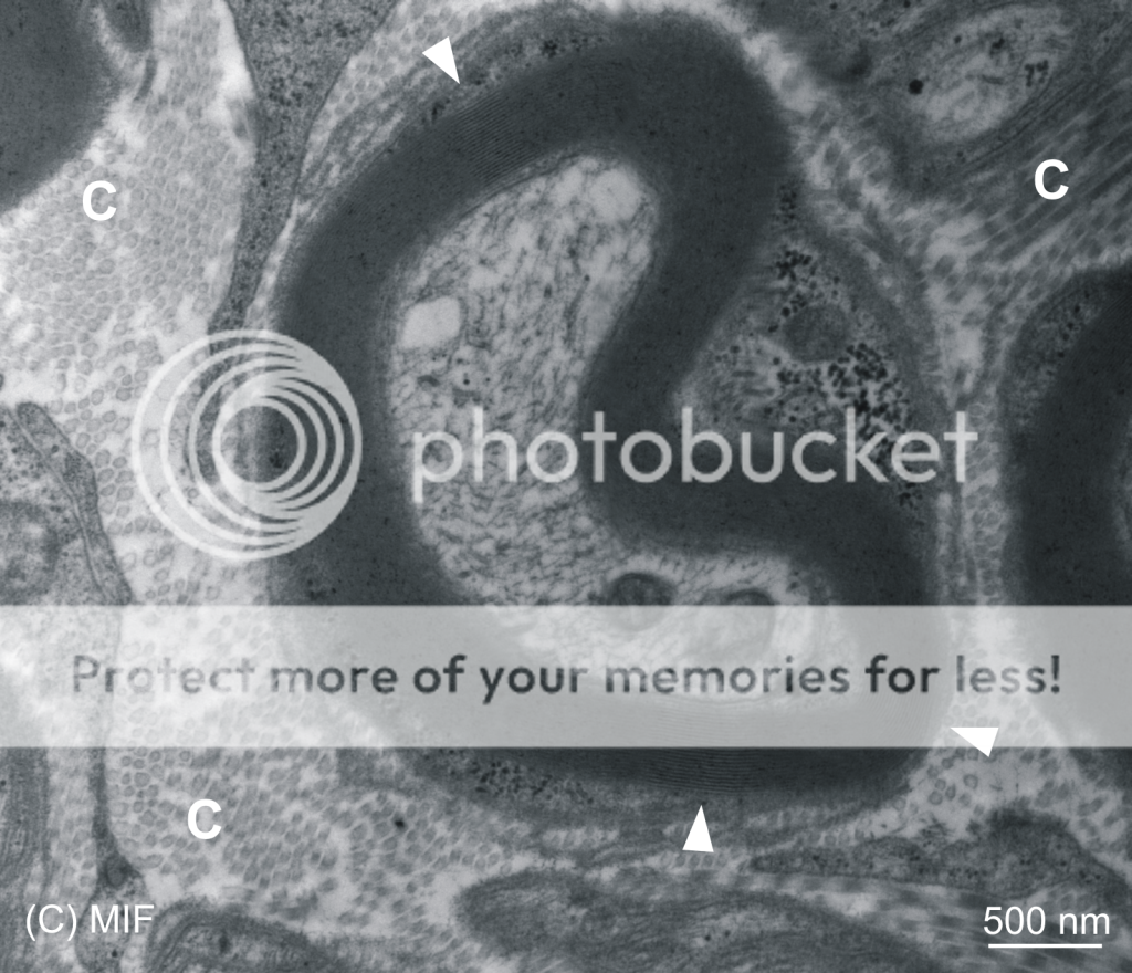 H7650 TEM | Microscopy and Imaging Facility